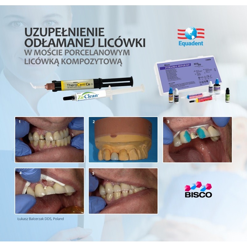 Intraoral Repair Kit - zestaw do napraw wew-ustnych (naprawa porcelany ...