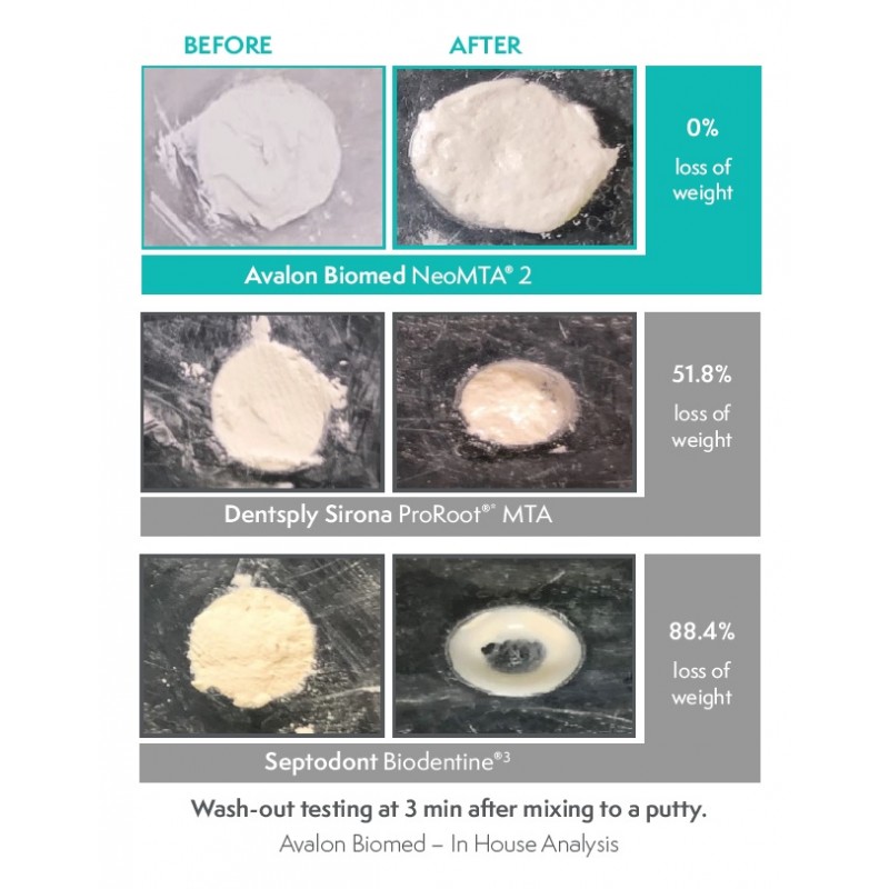 NeoMTA 2 PLUS - bioceramiczny i bioaktywny uszczelniacz na bazie MTA ...