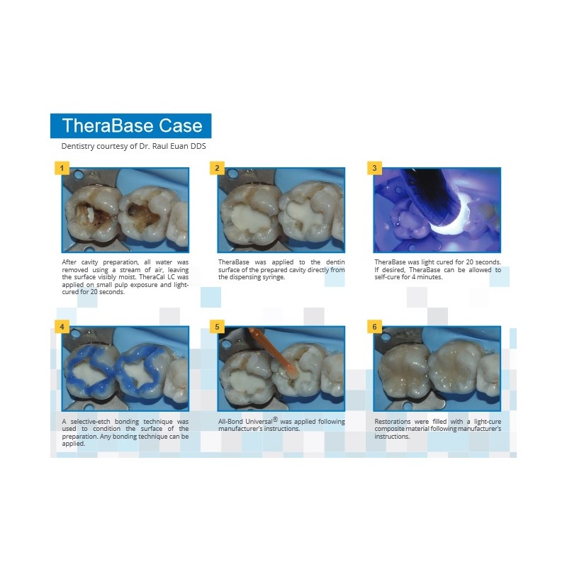 TheraBase Ca - podkład uwalniający wapń z rodziny THERA od BISCO - Nowość