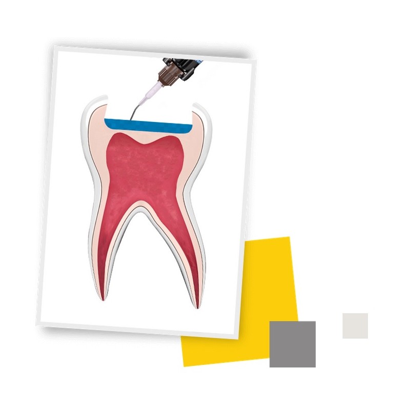 TheraBase Ca - podkład uwalniający wapń z rodziny THERA od BISCO - Nowość